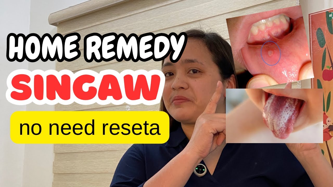 Home Remedy para sa SINGAW sa bata by Dr. Pedia Mom - YouTube