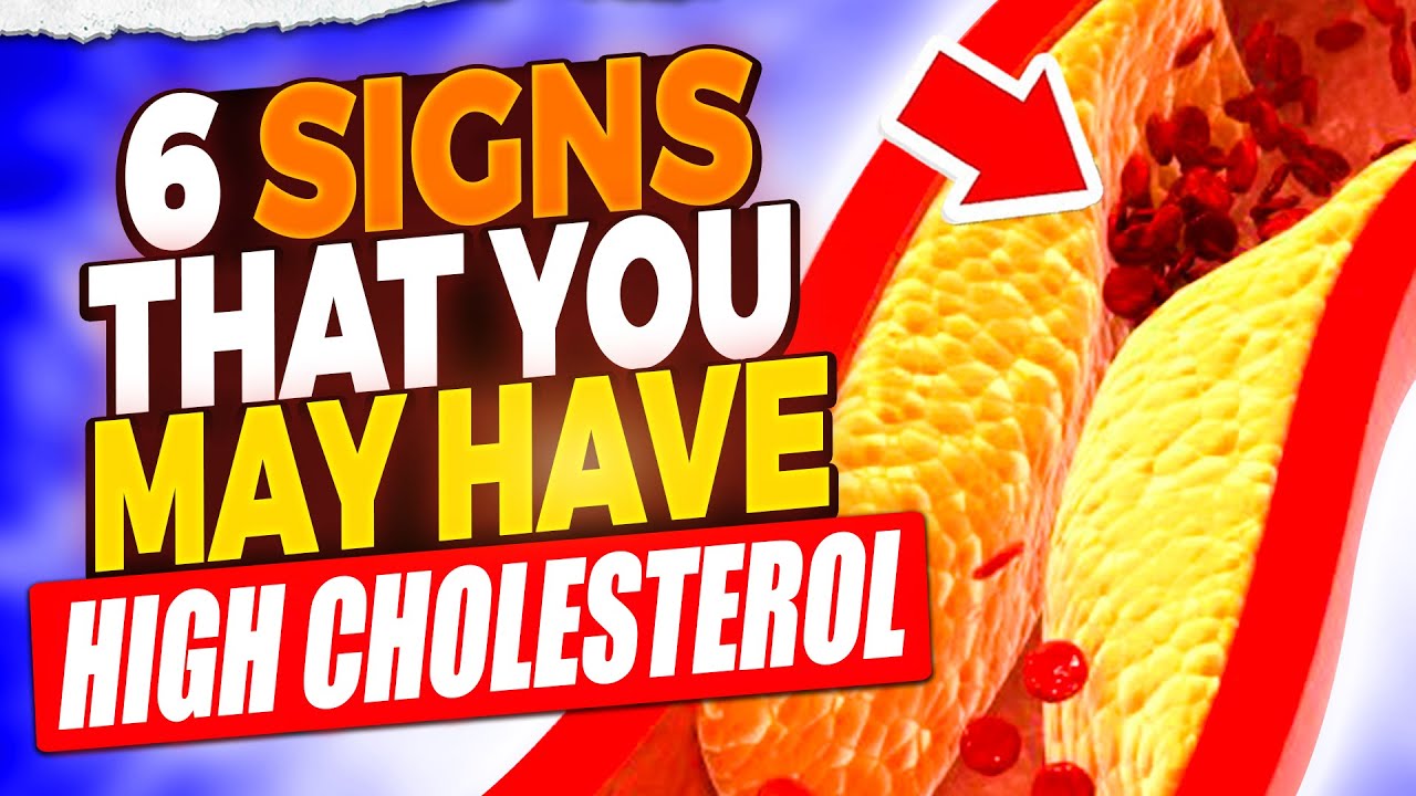 High Cholesterol Alert: 6 Symptoms You Shouldn't Ignore - YouTube