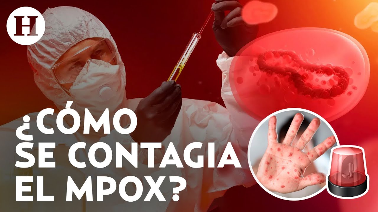 ¡Alerta por Mpox! Estos son los síntomas de la enfermedad que la OMS ...