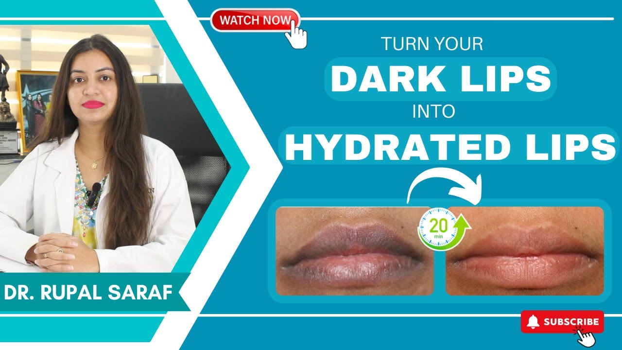 Get Rid of DARK LIPS in 20 MINUTES| Medical Treatment for Dark lips |Dr ...