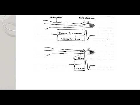 Nerve conduction velocity measurement - YouTube