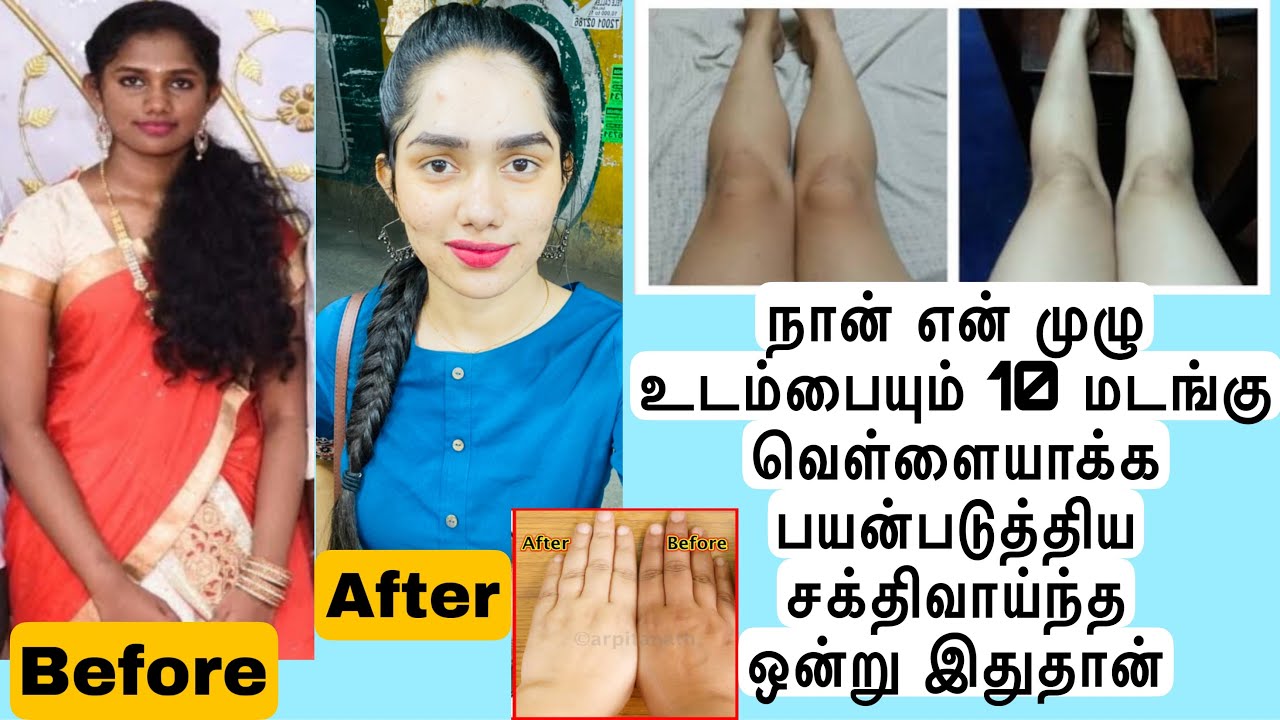 Very powerful full body whitening remedy for my 10 shades lighter body ...