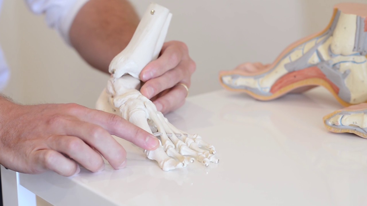 Corrective Foot Solutions Presentation - YouTube