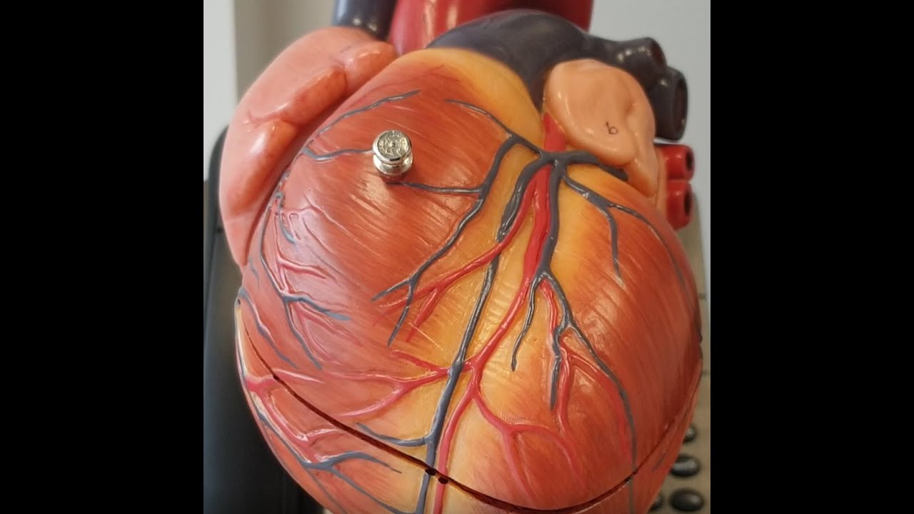 Cardiac anatomy overview - YouTube