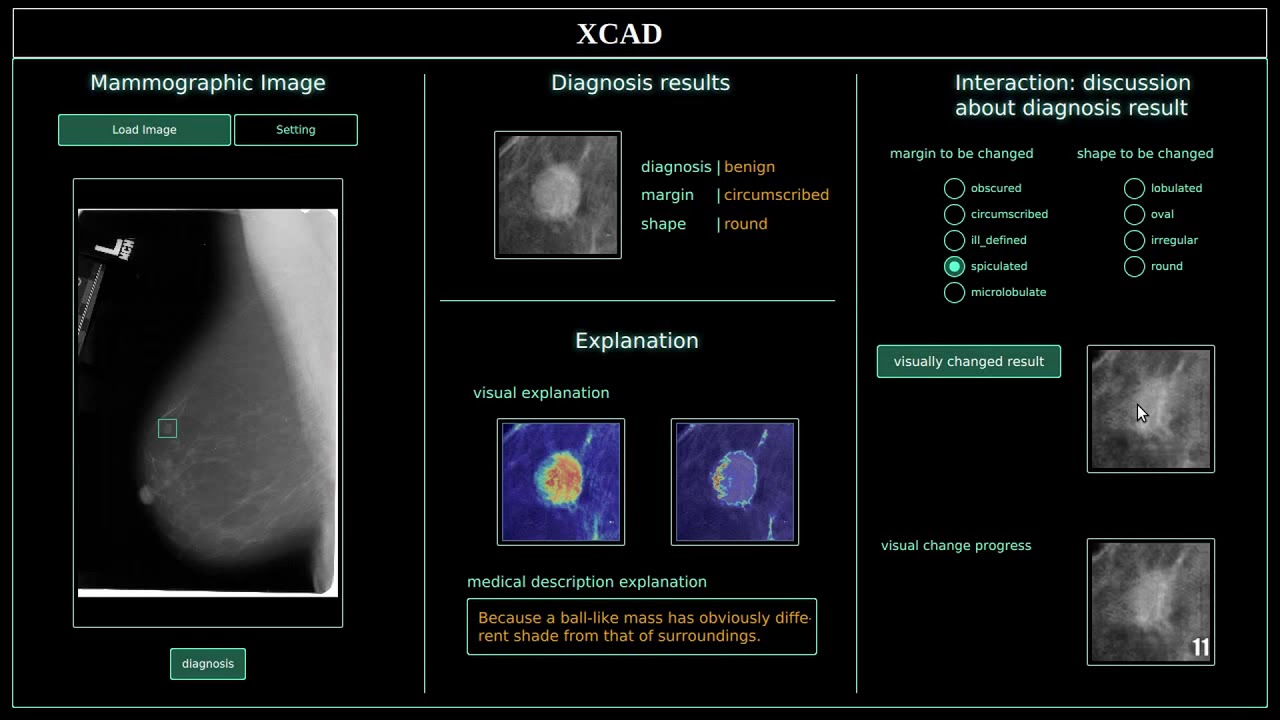 Explainable CAD (XCAD) - YouTube