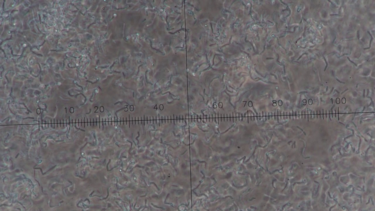 Bacillus cereus - YouTube