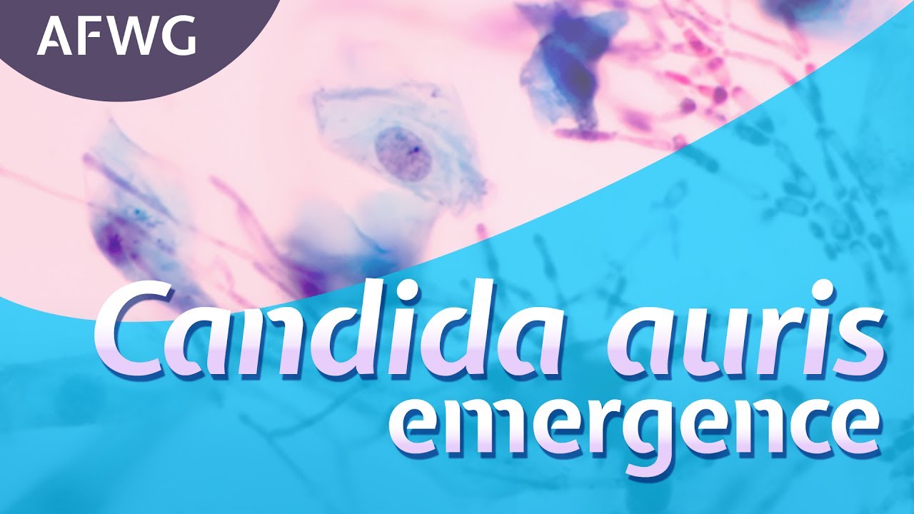 Candida auris Emergence – Dr M Chayakulkeeree - YouTube