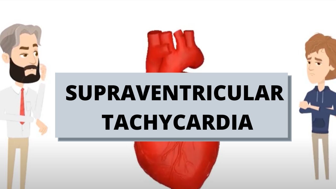 Everything you need to know about supraventricular tachycardia - YouTube