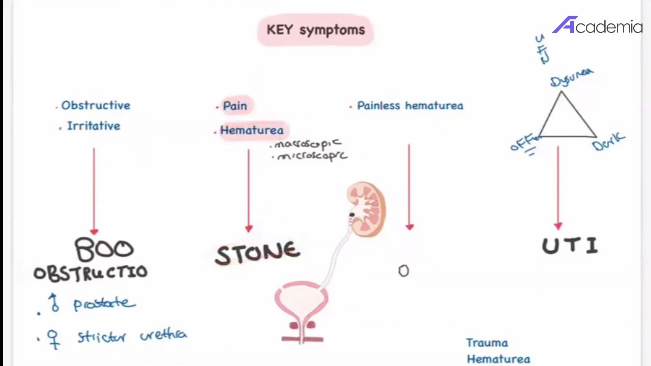 3-urological approach (Symptoms of urology -2) - YouTube