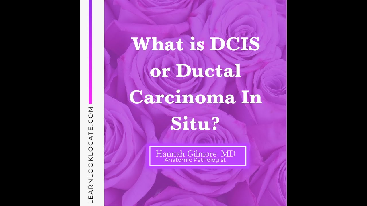What is DCIS or Ductal Carcinoma In Situ? - YouTube