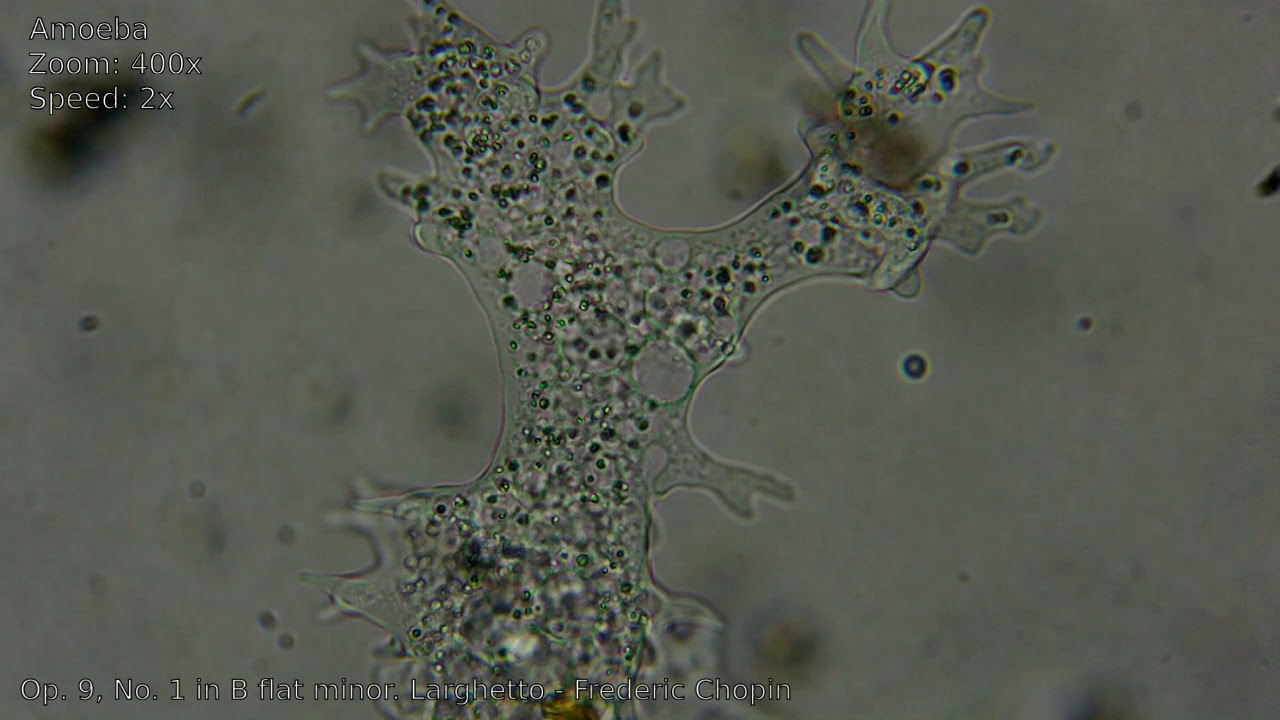 Amoeba Test - YouTube