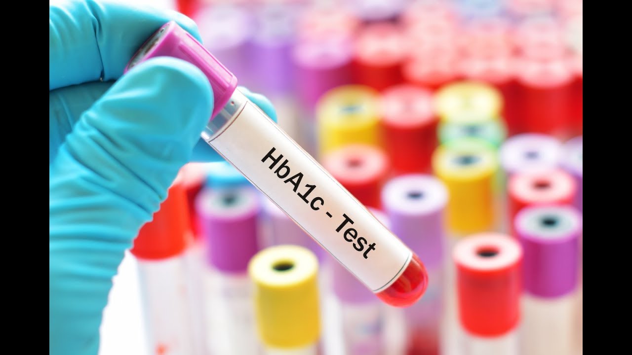 It's Not Just About Your A1C - Irl Hirsch, MD - YouTube