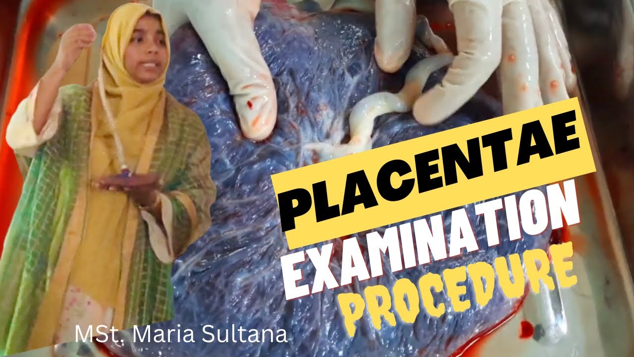 placenta examination -placental examination procedure || placenta ...