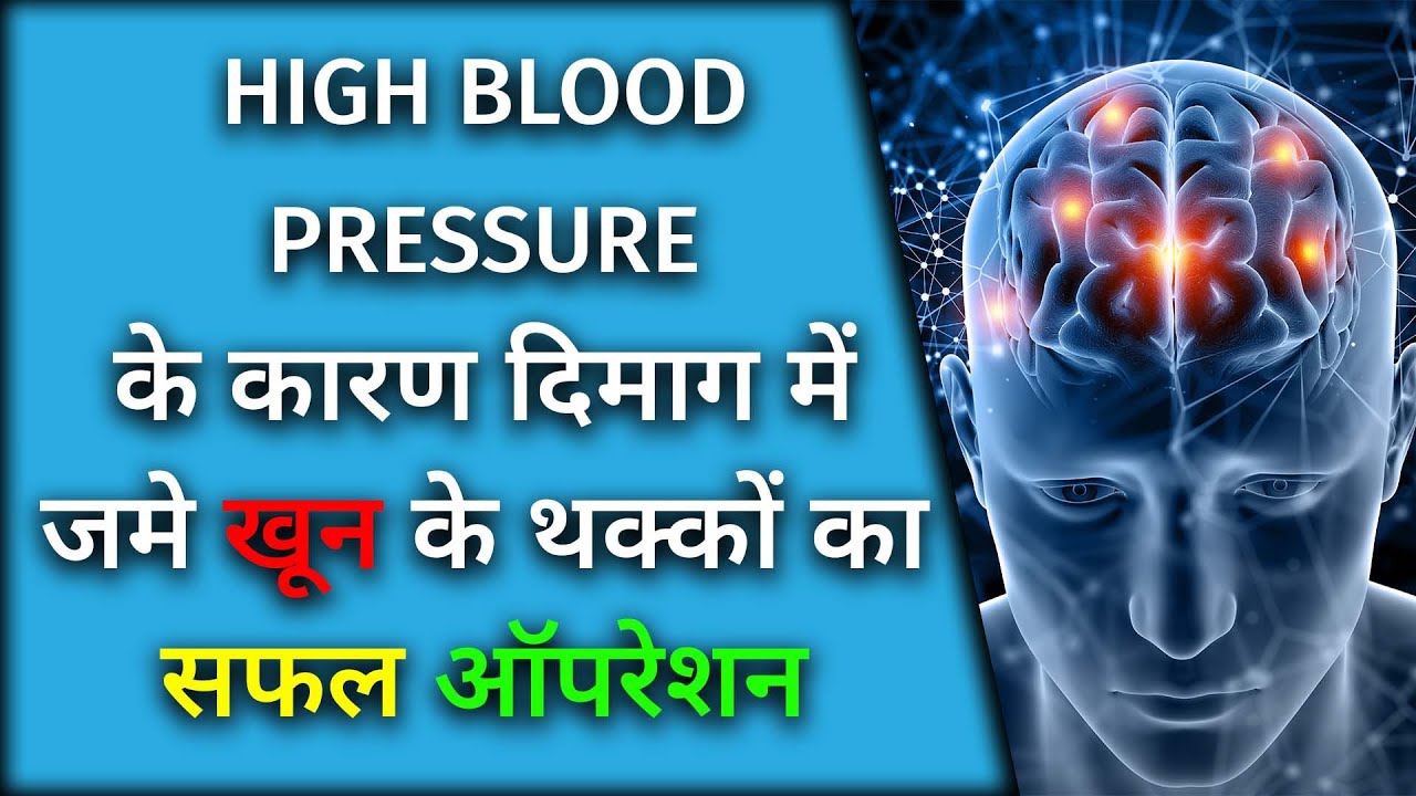 Neurosurgery for removing blood clots in brain causing paralysis and ...