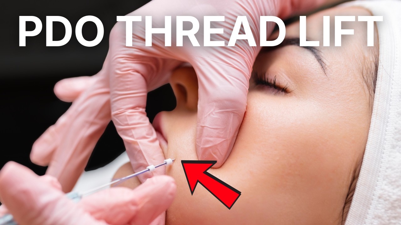 PDO Thread Lift: Skin Tightening Treatment without Surgery - YouTube