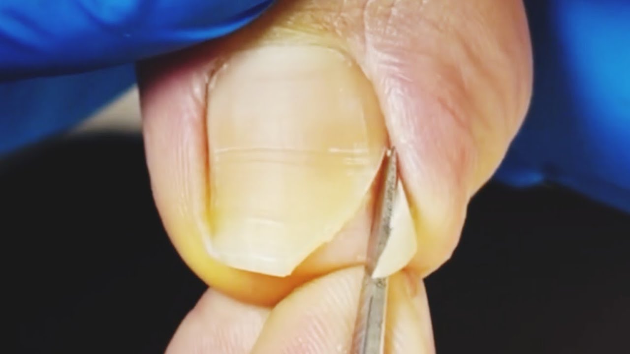 Triming inlays, Grandfather nail manicure (no1 manicure) - YouTube