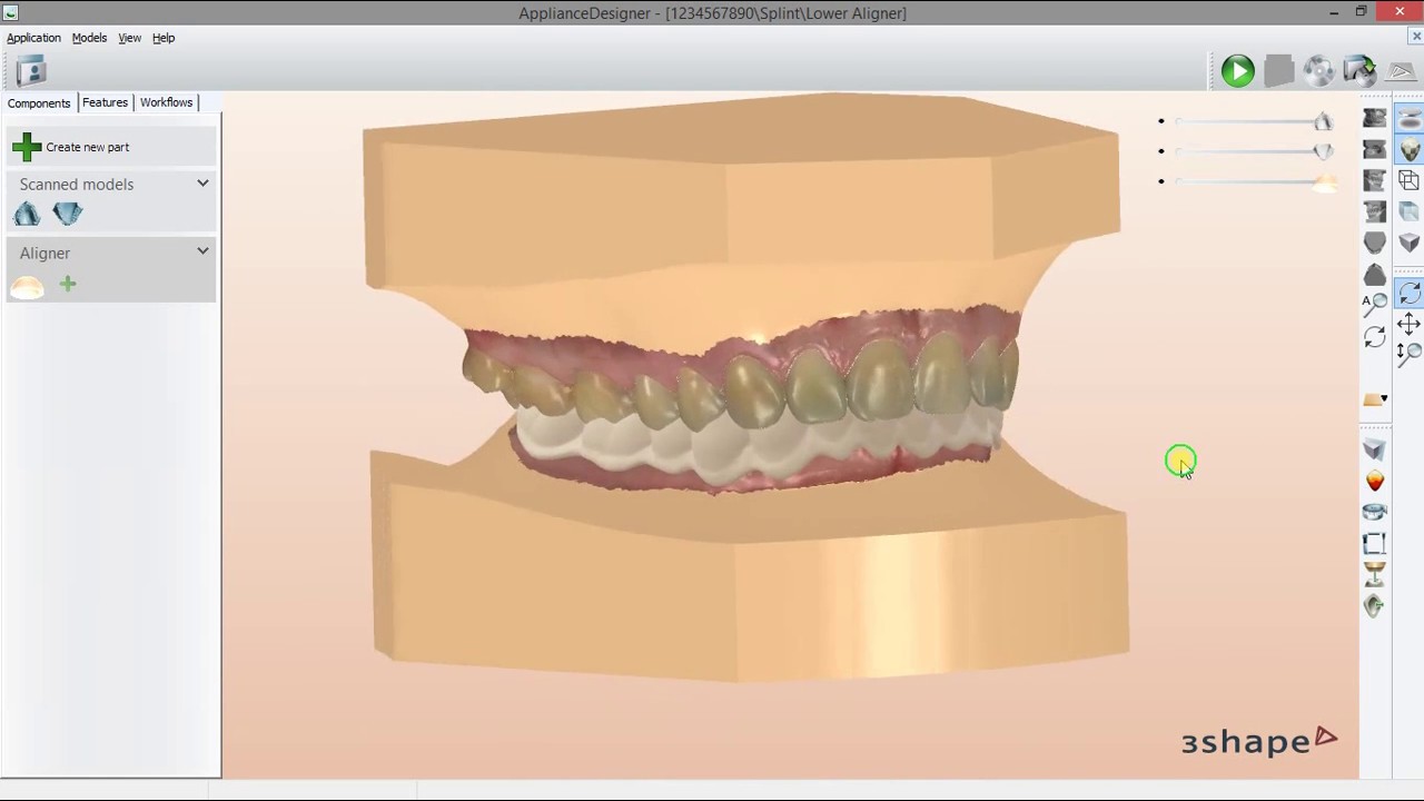 Aligner Appliance Design in 3Shape - YouTube