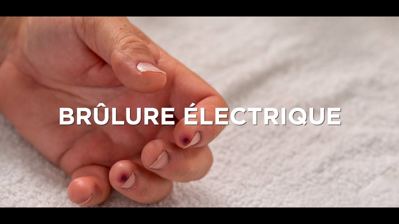YLEA - Maquillage de Secourisme : Comment réaliser une brûlure électrique ? - YouTube