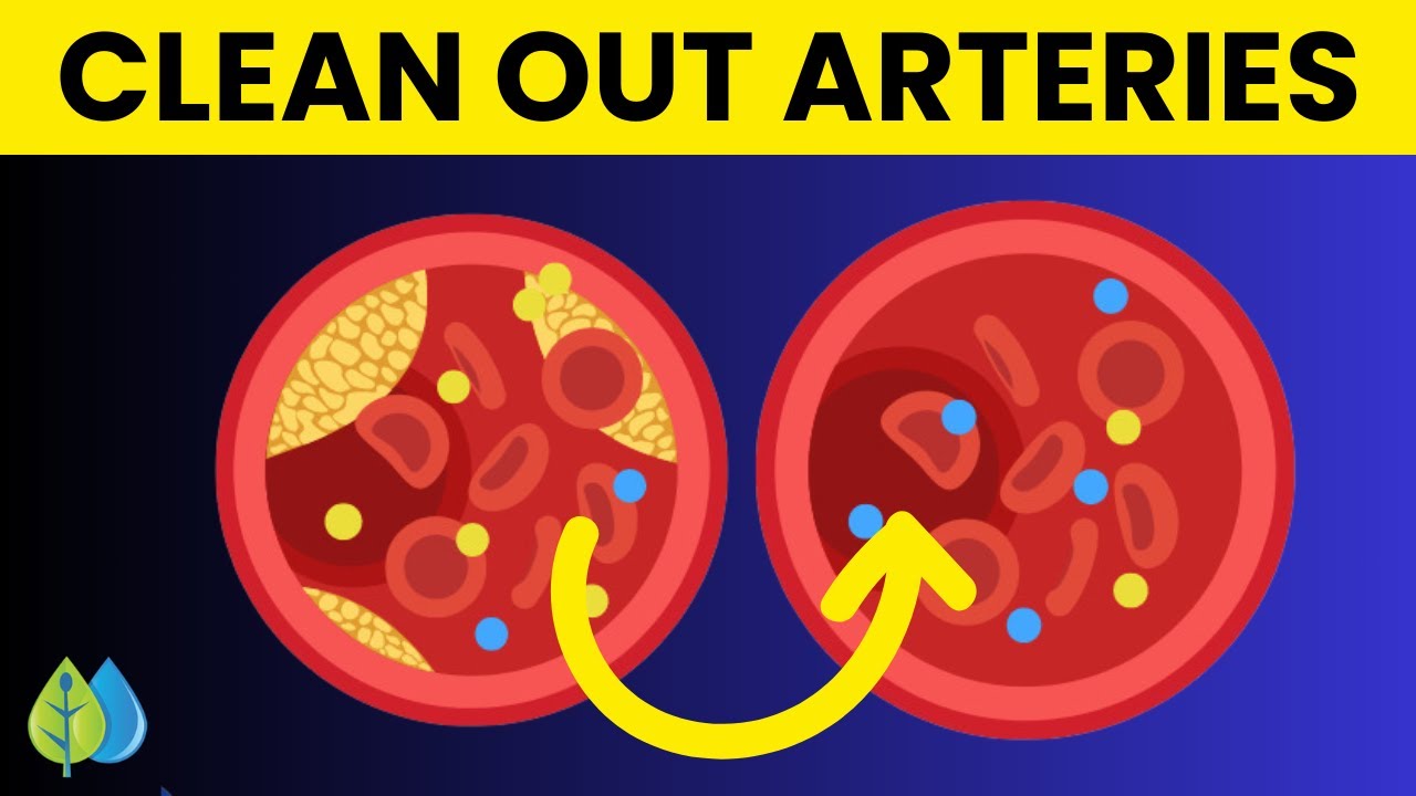 The Best CHECKLIST to Clean Out Your Arteries - YouTube