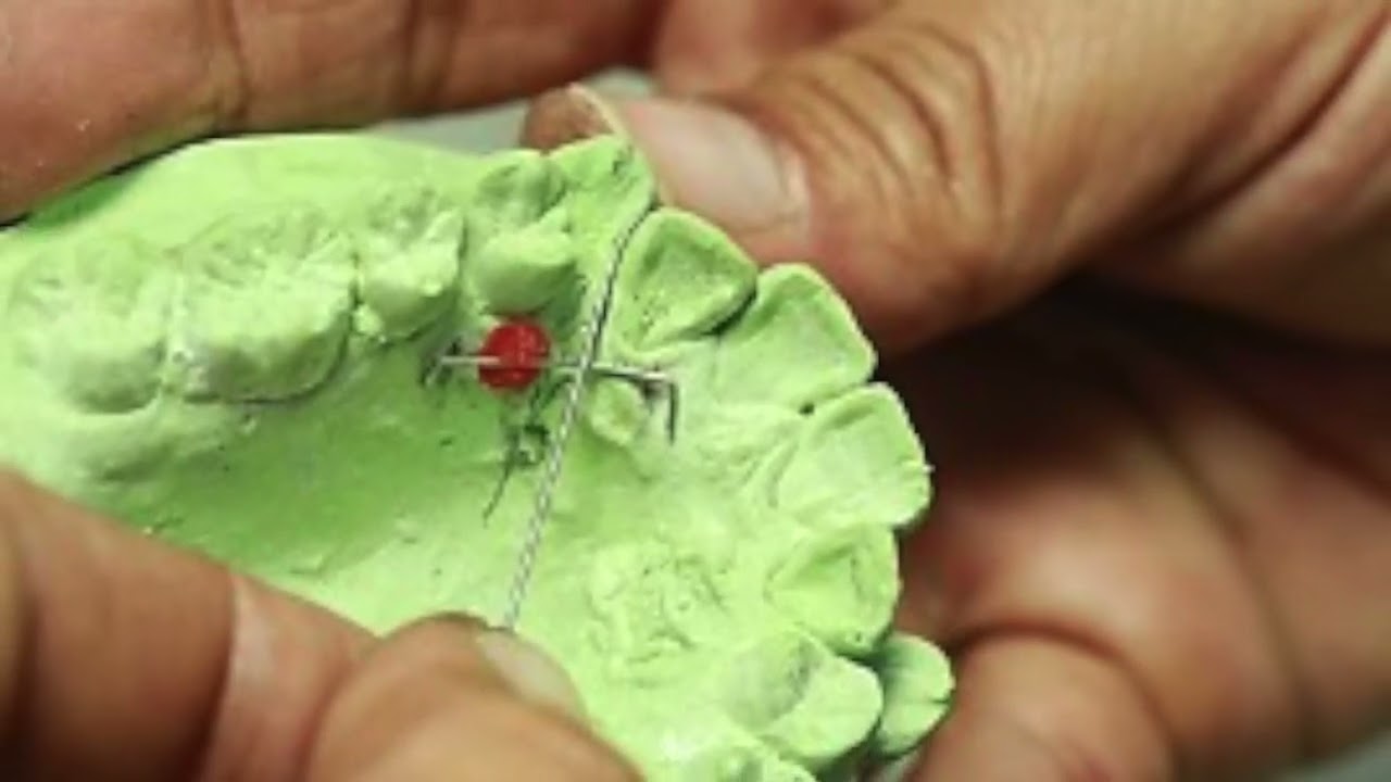 Palatal Finger Spring - YouTube