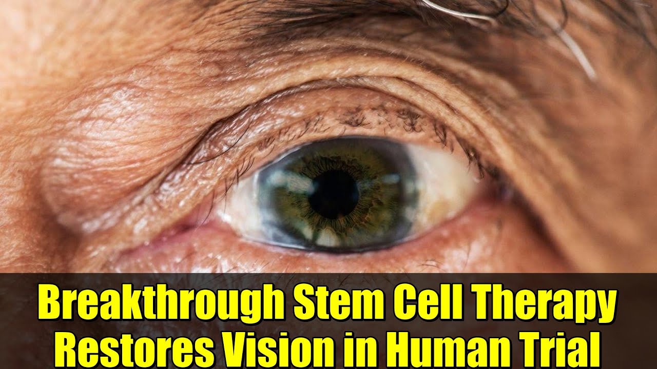 Breakthrough Stem Cell Therapy Restores Vision in Human Trial - YouTube