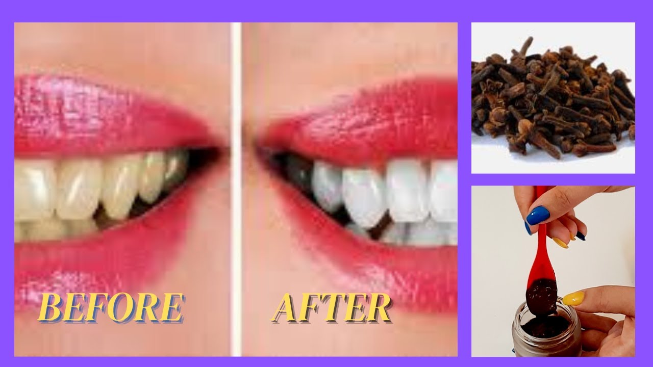 makeup:whitens teeth and eliminates bad odor in just two minutes,100 ...