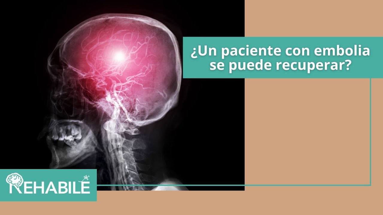 ¿Un paciente con embolia se puede recuperar? #Rehabilé - YouTube