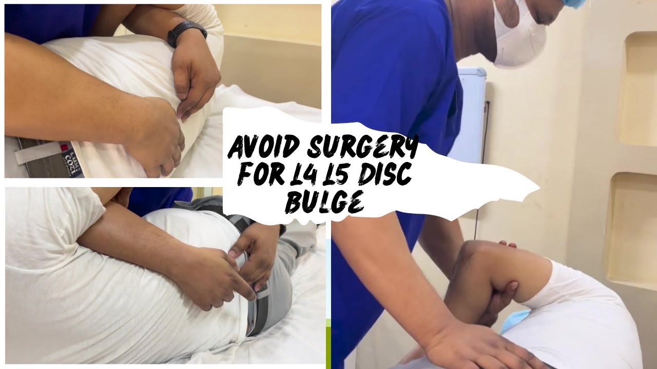 The Shocking Reason You Should Avoid Surgery for L4 L5 Disc Bulge - YouTube