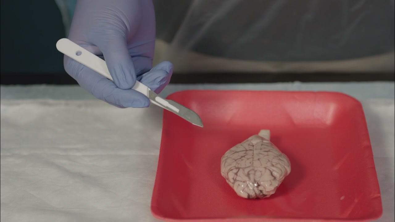 Proper scalpel use - YouTube