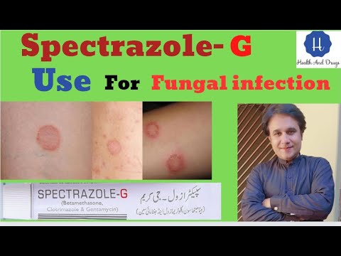 Spectrazole g cream |Spectrazole g cream for fungal infection ...