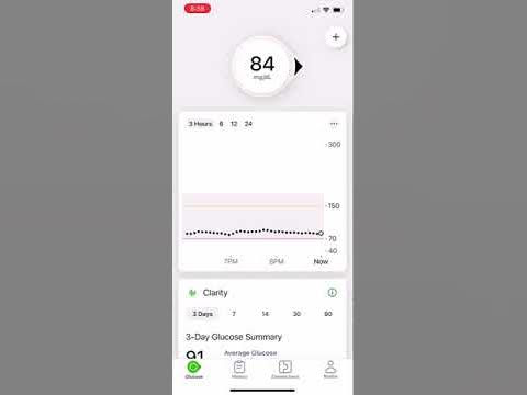Dexcom G7 Calibration - YouTube