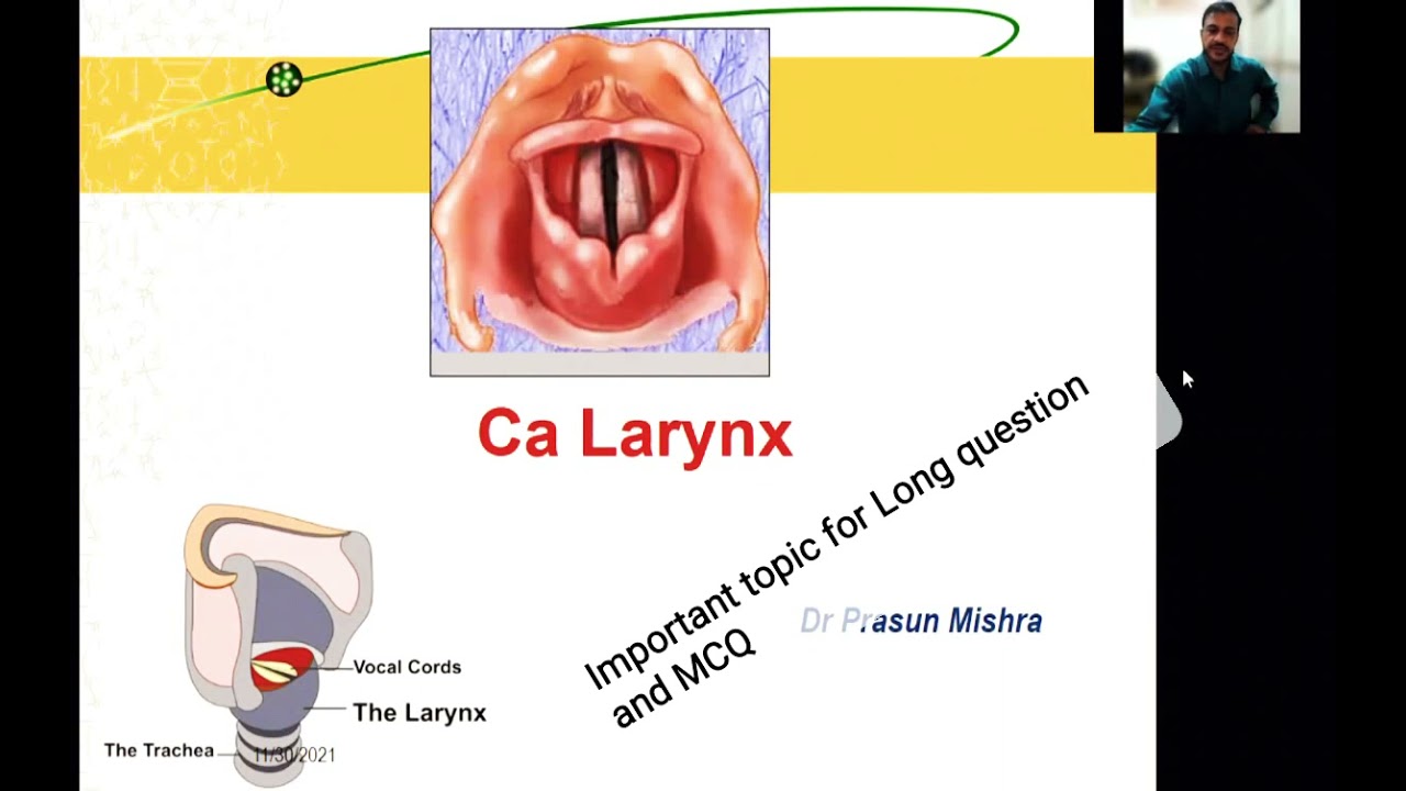 Ca Larynx ( Carcinoma Larynx) - YouTube