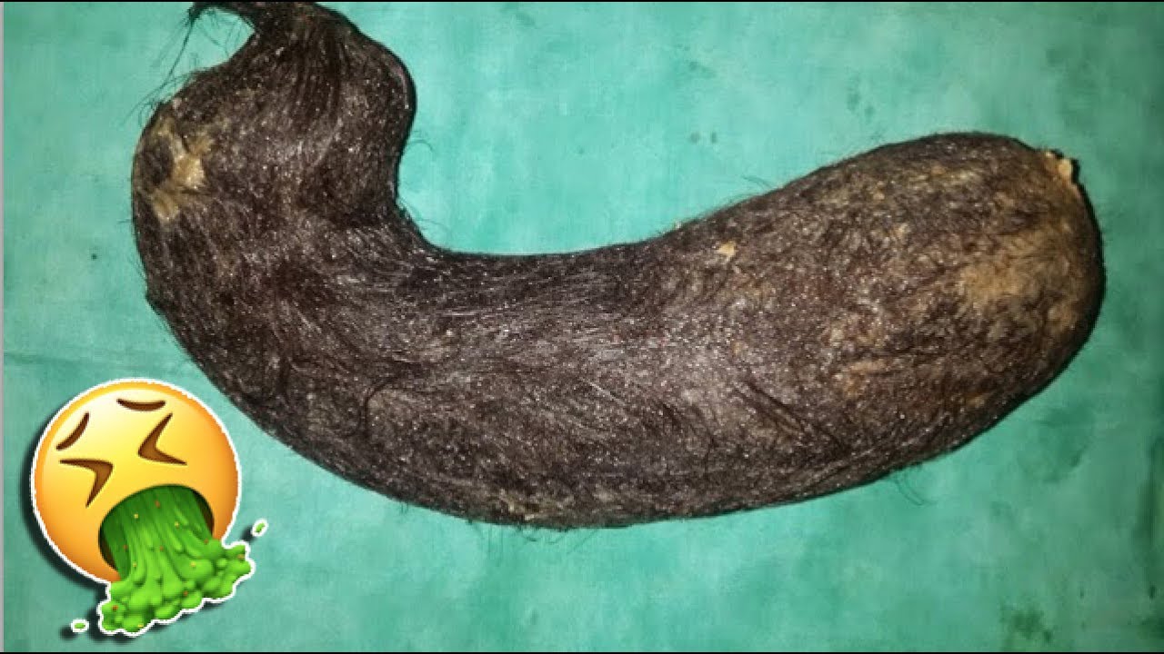 The NASTIEST DREAD Ever! - YouTube