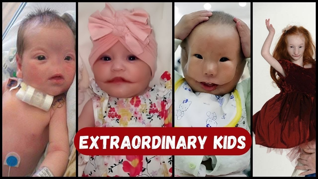 Extraordinary Kids with Unbelievable Conditions! - YouTube