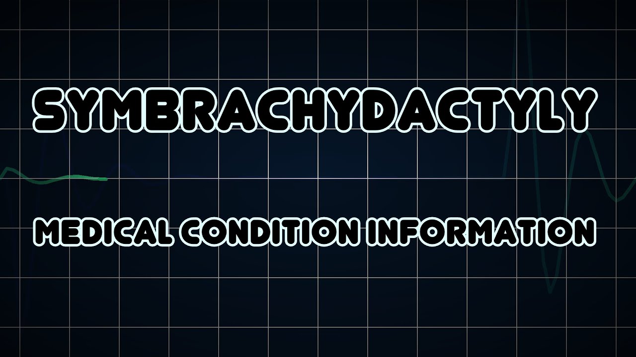 Symbrachydactyly (Medical Condition) - YouTube