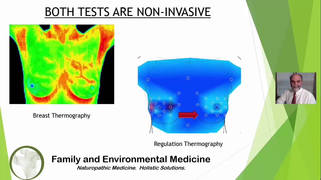 Breast Thermography versus Regulation Thermography - YouTube