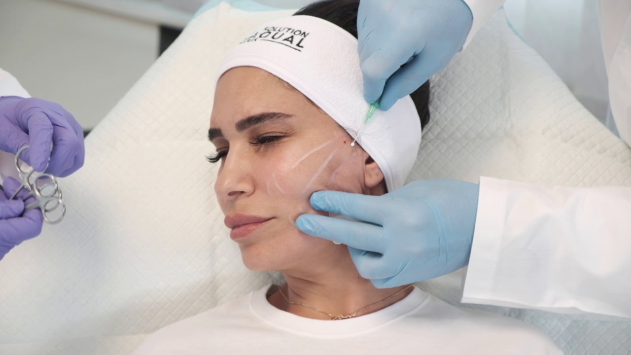 DERMAQUAL DQ 4D FACELIFT : 4D LIFTIG THREADS FACELIFT ANTIAGING JAWLINE ...