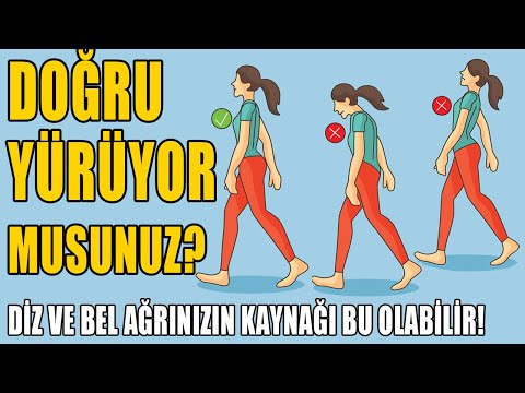 DOĞRU YÜRÜYOR MUSUNUZ? #aktifizyo #doğruyürüyüş #dizağrısı #belağrısı #fizyoterapist