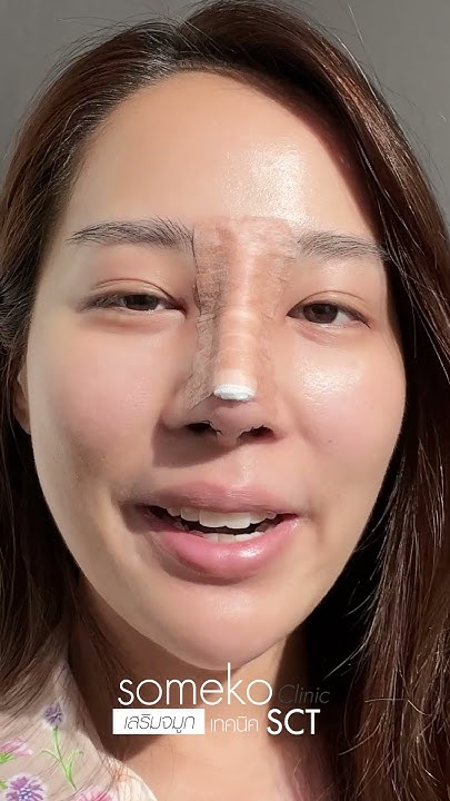 ทรงจมูกสไตล์ #หมอมิวsomeko เทคนิค SCT #somekoclinic #โซเมโกะ - YouTube