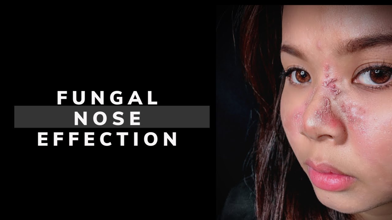 How to make Fungal Nose Effection ( easy sfx makeup nose) - YouTube