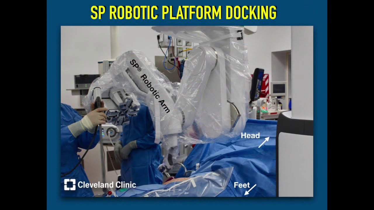 AUA2019 V08-01 Robot-Assisted Single Port Partial Nephrectomy Using the ...