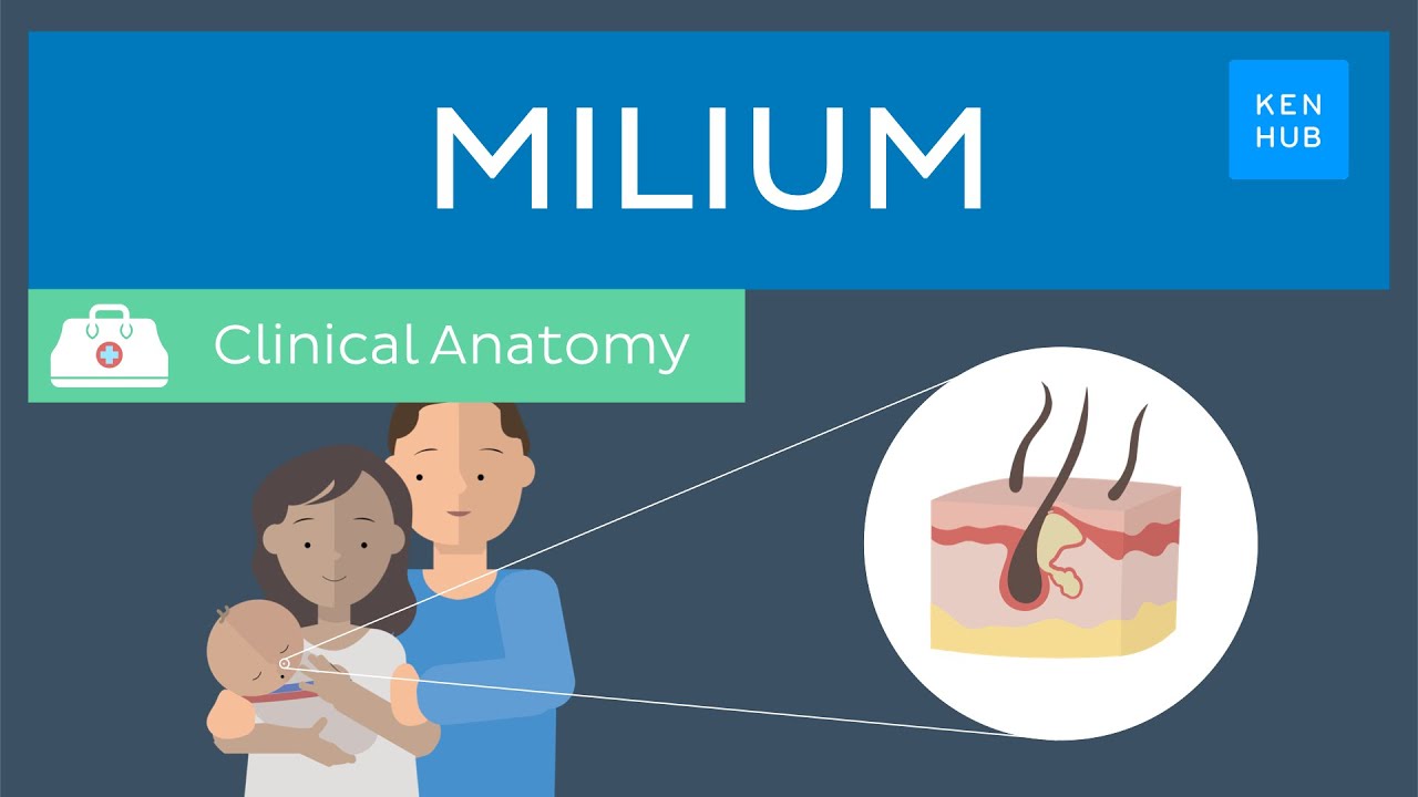 Milium Definition Symptoms Treatment And Management Kenhub Youtube