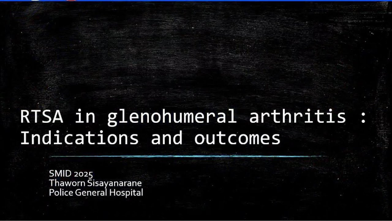 22 RTSA in GH arthritis Indicaiton and outcomes - YouTube