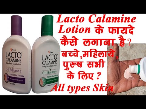 Lacto Calamine Lotion for Oily or Non oily Skin ? Green Vs Purple Lacto ...