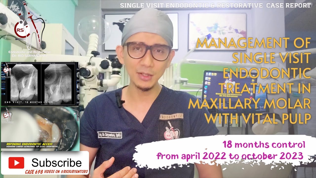 SINGLE VISIT ENDODONTIC TREATMENT, 18 MONTHS CONTROL, NEGOTIATING MB2 ...