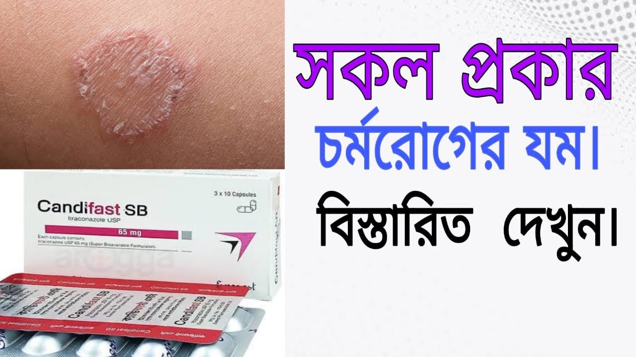 Cap. Candifast sb 65 mg ( itraconazole super bioavailable) full review ...