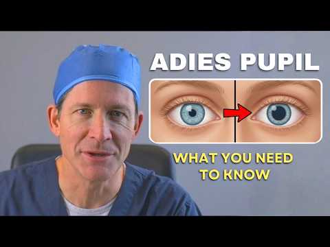 Adie’s Pupil Explained: Why One Pupil is Larger & Light Sensitivity