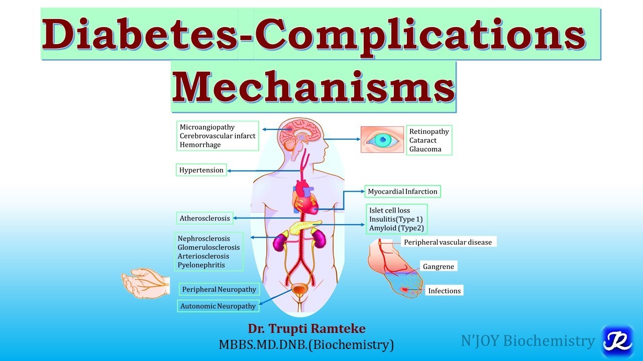 Diabetes Mellitus Type 2 Complications Diabetes Mellitus Type 2 Complications