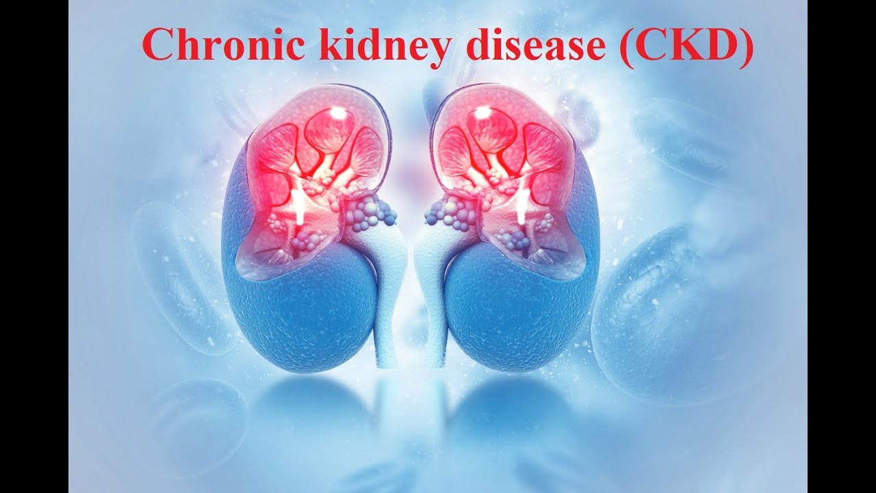 Chronic kidney disease (CKD) complications - YouTube