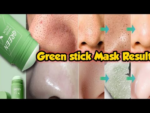 Green mask stick Review|viral stick mask result|tiktok viral stick mask ...